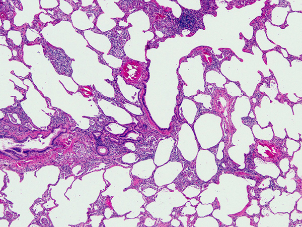 Pulmonary Pathology Society