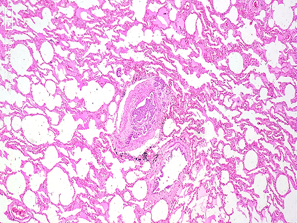 Pulmonary Pathology Society