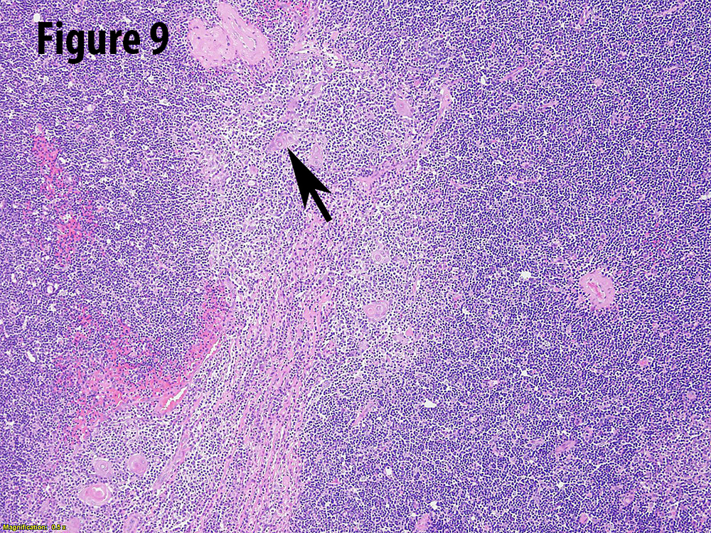 Pulmonary Pathology Society