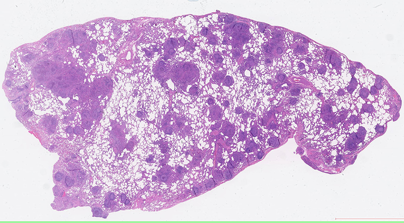 Pulmonary Pathology Society
